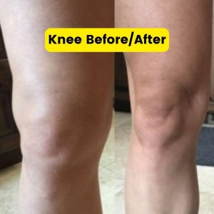 Infrared Sauna For Rheumatoid Arthritis - Rheumatoid Arthritis Solutions